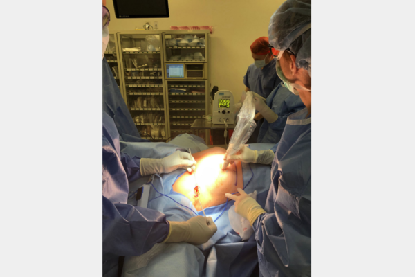 Groundbreaking breast cancer treatment now at Bayhealth Sussex - RFTC Japan